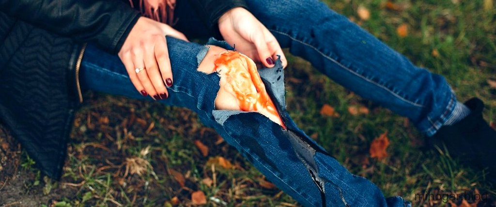 ¿Cómo usar los parches para callos?: Guía de uso y tipos de apósitos ...